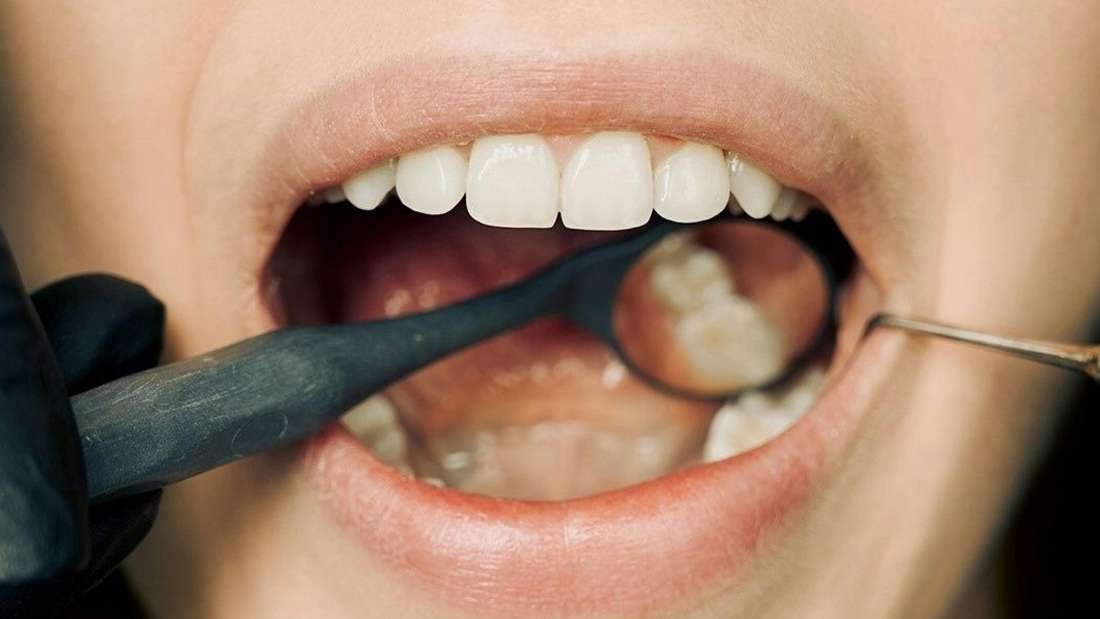 How to Deal with Broken Teeth and Knocked-Out Teeth in Hartford, CT ...