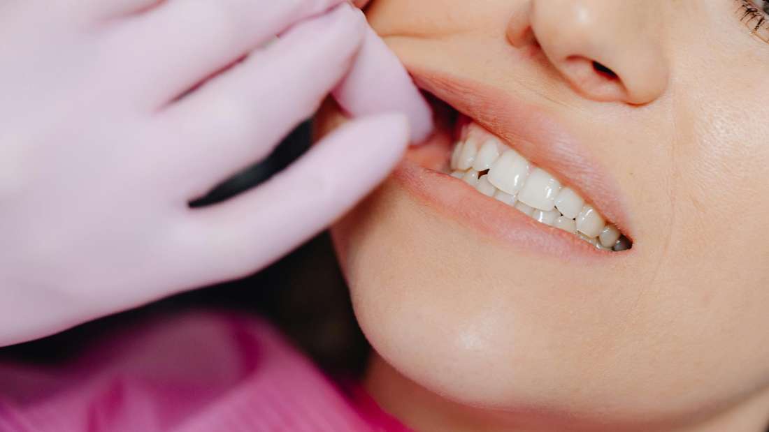 The Consequences of Untreated Cavities: What You Need to Know ...